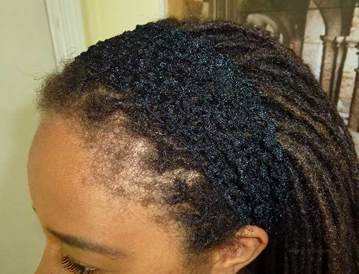 head band locs, braids, natural hair – Beauty Coliseum